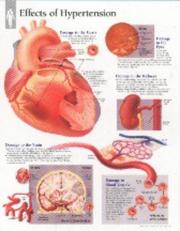 Effects of Hypertension by Scientific Publishing | Open Library